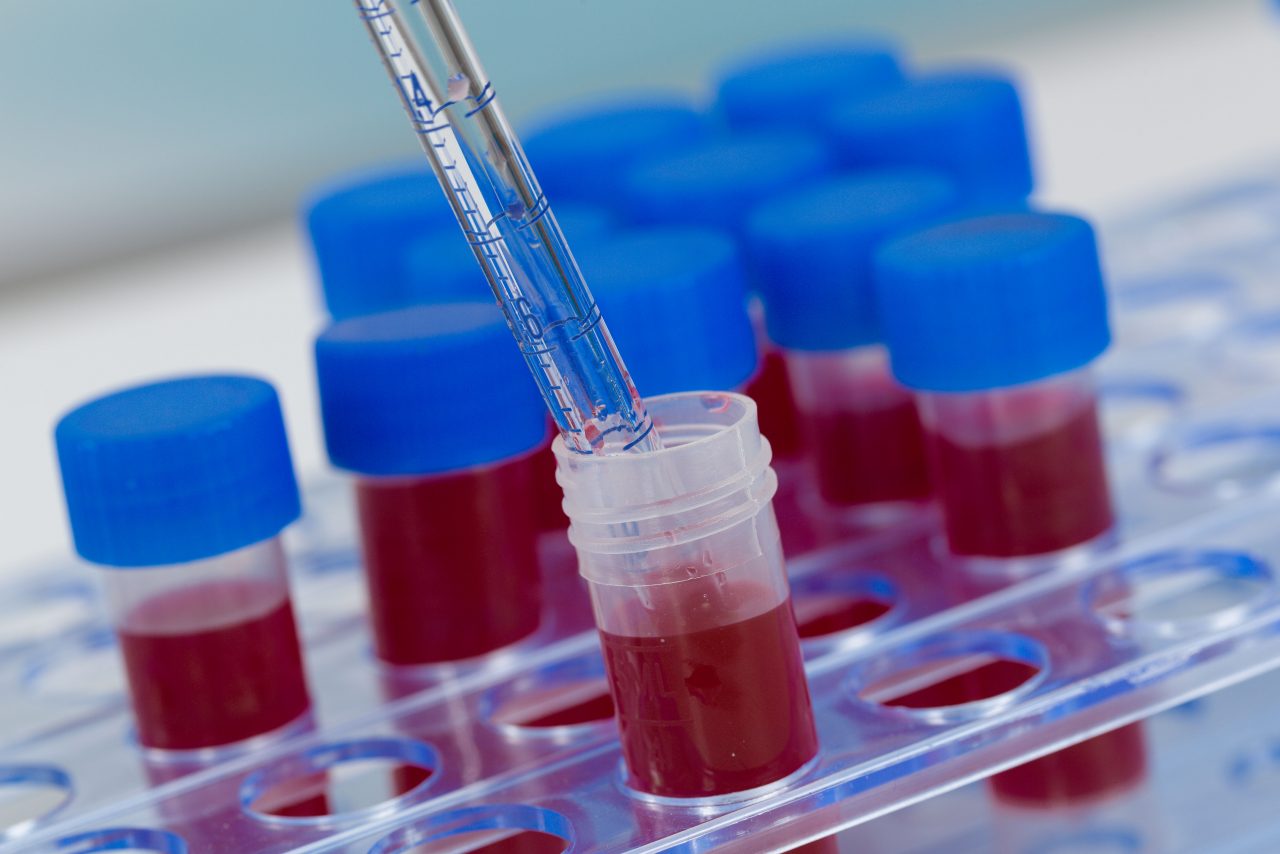 Polymorphprep | Density Gradient Media