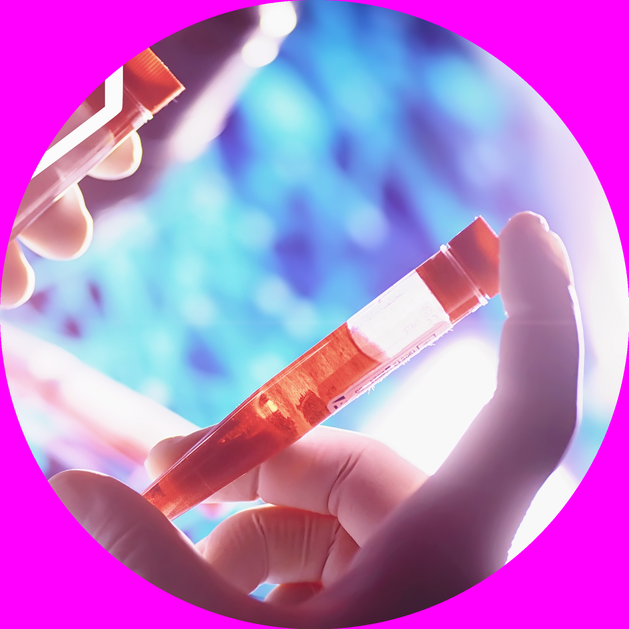 Lymphoprep | Density Gradient Media