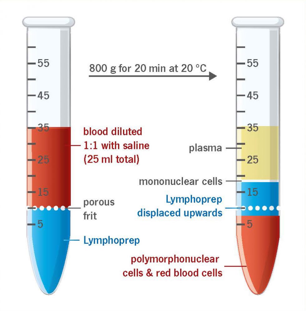 Lymphoprep Tube | Density Gradient Media
