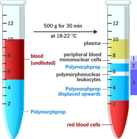 Polymorphprep | Density Gradient Media