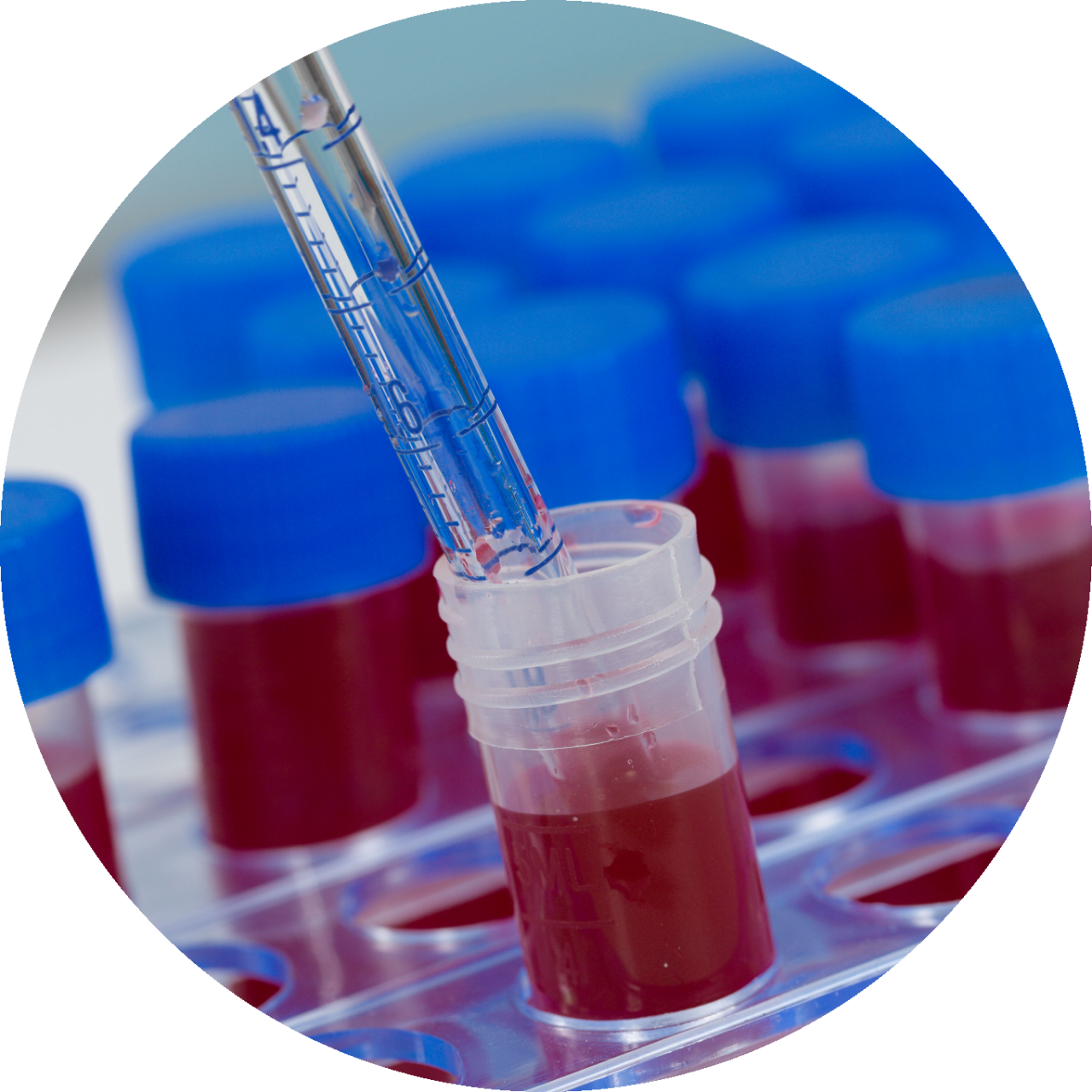 Polymorphprep | Density Gradient Media