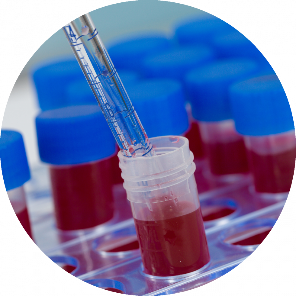 Polymorphprep | Density Gradient Media