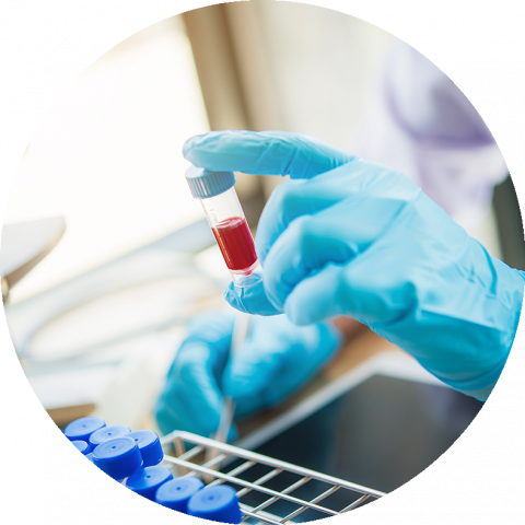 Lymphoprep Tube | Density Gradient Media